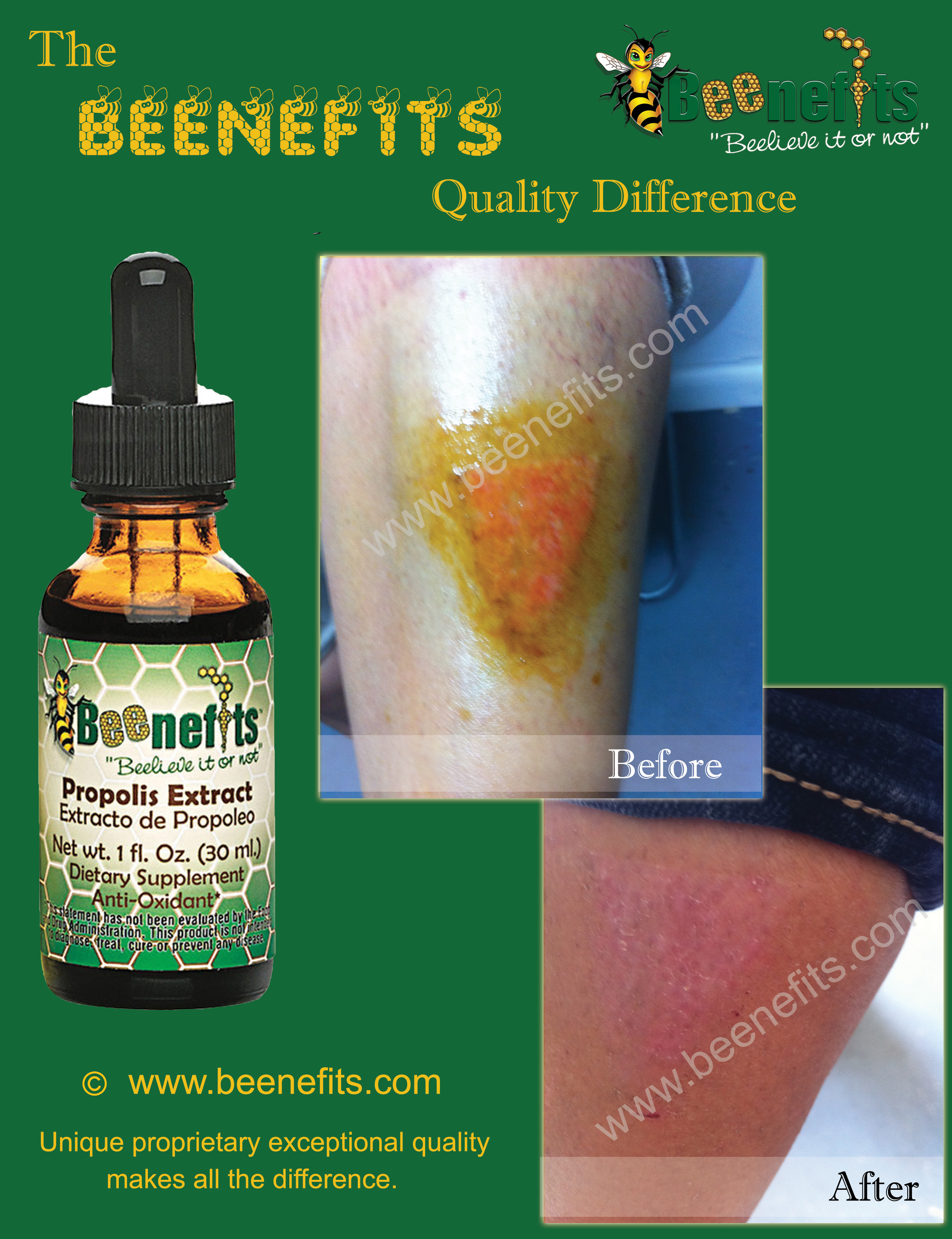 propolis mania | The Benefits of Beenefits® propolis extract